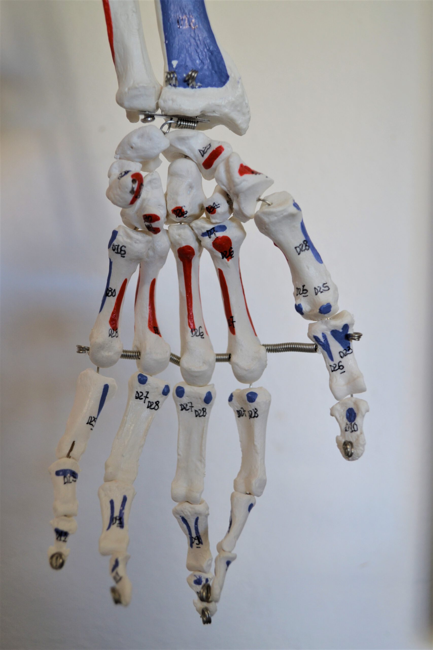 Distale Radiusfraktur - Physio Bosse